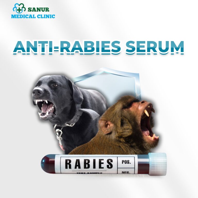 Rabies and Anti-Rabies Serum (SAR): What You Need to Know – Sanur ...